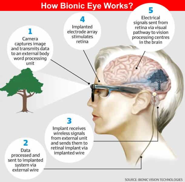 What Is Bionic Eye And How Does It Work Electrical Technology